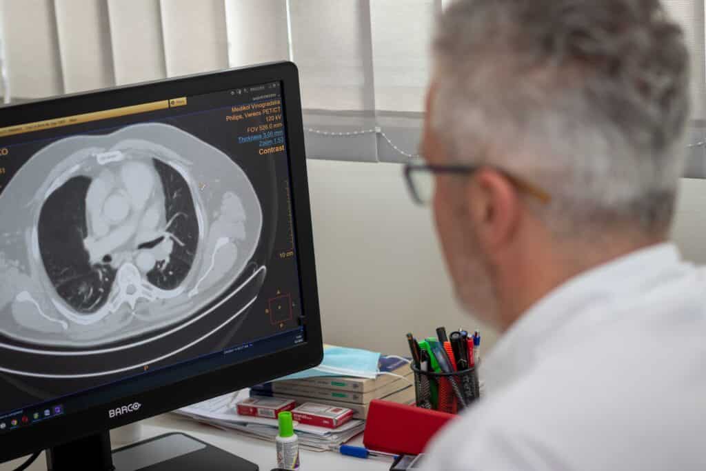 Što je low dose CT pluća (LDCT) i kada se koristi?